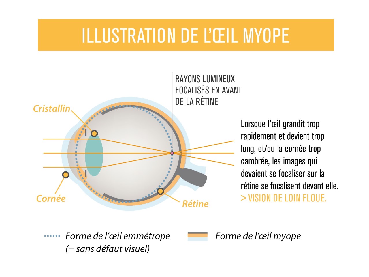 Miyosmart - Histoire D'y Voir Junior Opticien Pour Enfants à Bordeaux